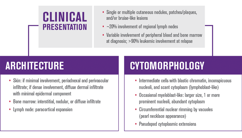 Diagnosing BPDCN | BPDCN Information
